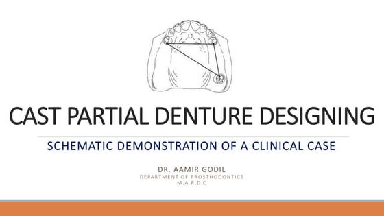 Cast partial denture design | PDF | Dental Health | Diseases and Conditions