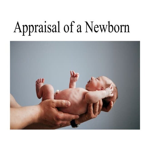 Appraisal_of_a_Newborn_Presentation new.pptx
