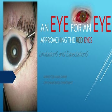 Approaching the eyes | PPT