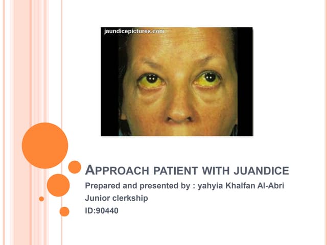 jaundice-(three types)- pre hepatic, hepatic , post hepatic | PDF