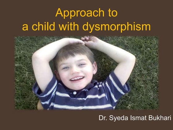 CHARGE SYNDROME.pptx