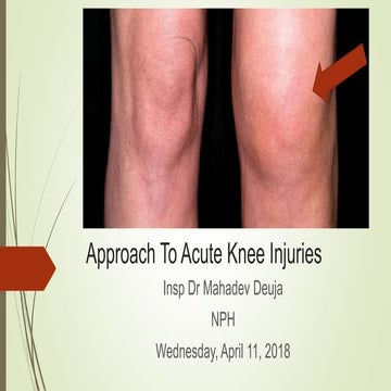 Approach to acute knee injuries (knee injury) | PPT