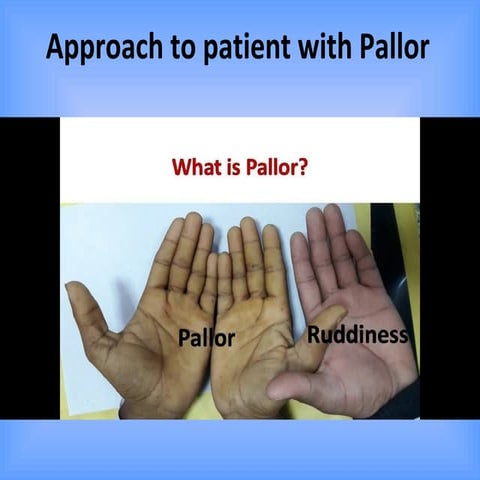 Approach to a pationt with pallor | PPT