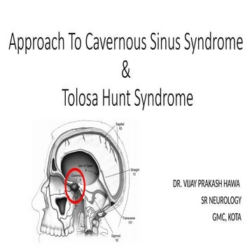 Approach To Cavernous Sinus Syndrome.pptx