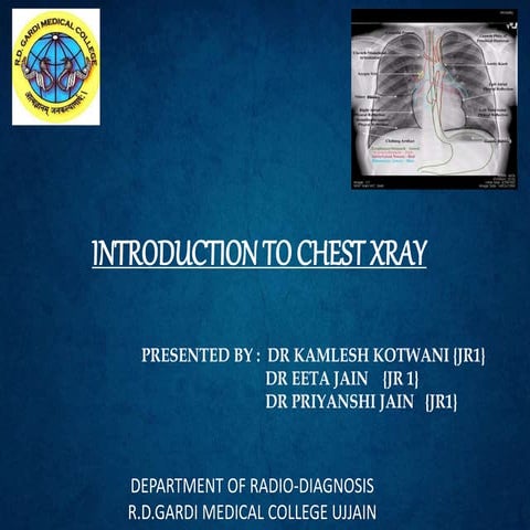 The radiology assistant chest x ray - basic interpretation | PDF