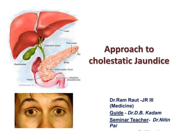 jaundice-(three types)- pre hepatic, hepatic , post hepatic | PDF ...