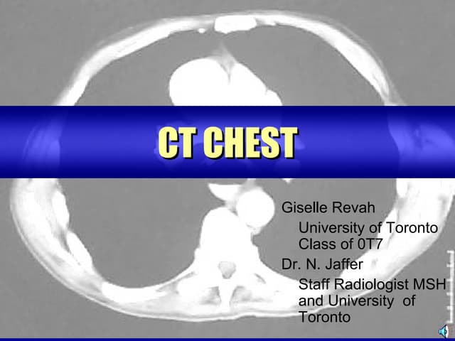 Ct chest anatomy | PPTX