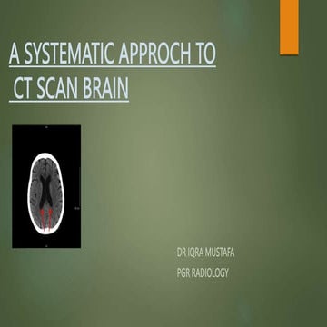 Approach to CT scan brain.pptx Uuuuuu | PPTX