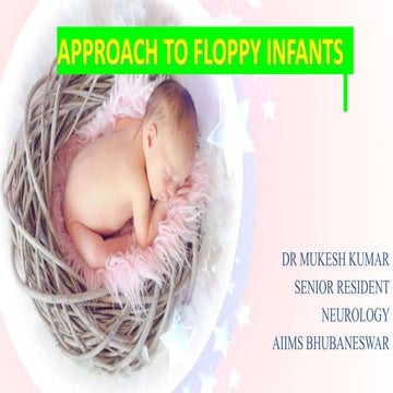 Approach to floppy infant | PPTX