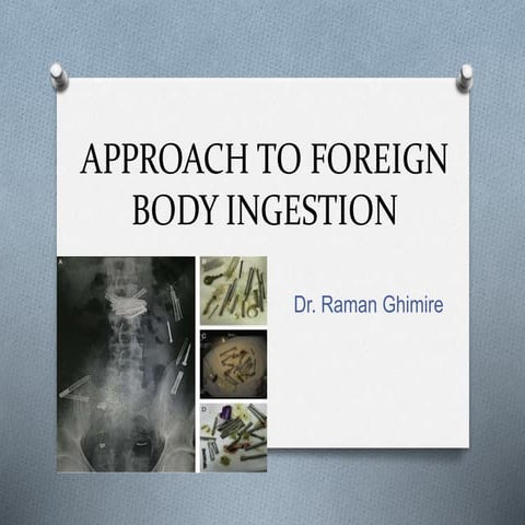 approachtoforeignbodyingestion-190113140740.pdf