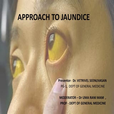 Approach_to_Jaundice_PPT.pptx,.......,............... | PPTX