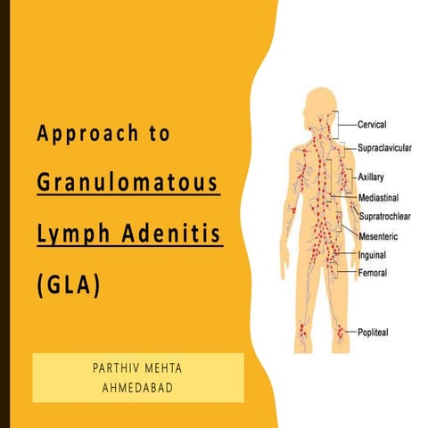 Approach to lymphadenitis pmm | PPTX