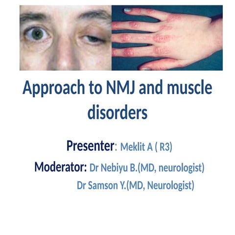 Approach to NMJ and muscle disorders.pptx