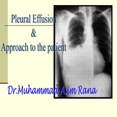 Pleural effusion(X-ray Findings) | PDF