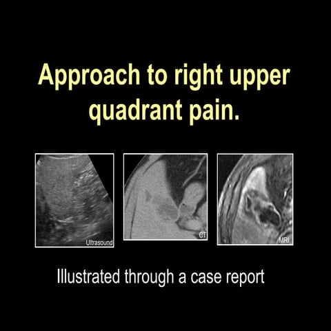 Approach to right upper quadrant pain-lessons from a case | PPT