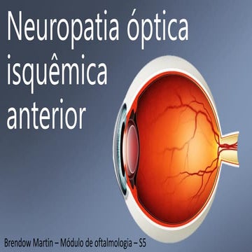 Neuropatia óptica isquêmica anterior | PPT