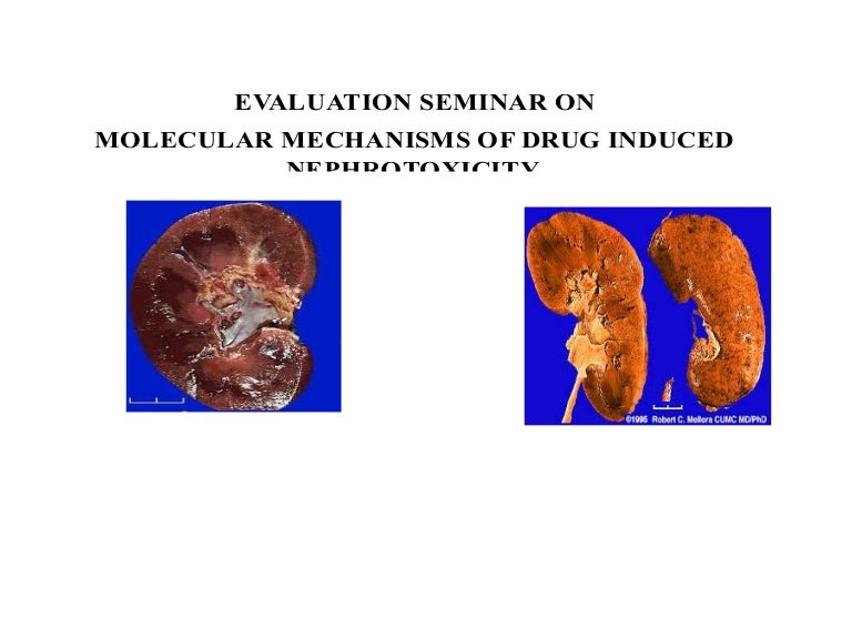 Molecular mechanism of drug induced nephrotoxicity