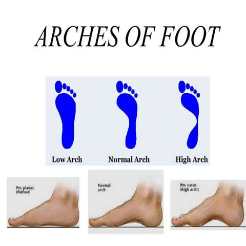 relevant anatomy of Arches of foot the master in topic | PPTX