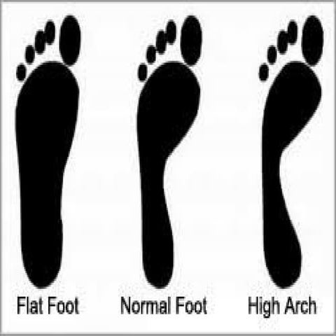 Arches of foot.ppt