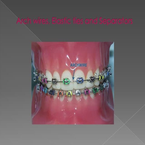 Arch wires, elastic ties and separators | PPTX