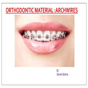 Archwires In Orthodontics.pptx