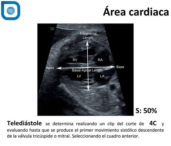 TN - DV - Cardiopatías congénitas | PPT
