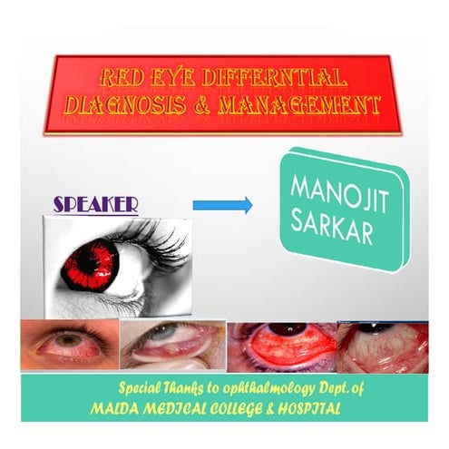 A review of red eye by manojit | PDF