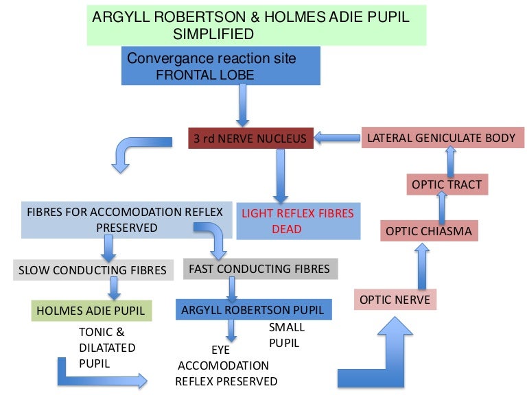 Argyll robertson & holmes adie pupil simplified