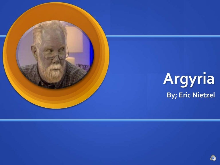 Argyria