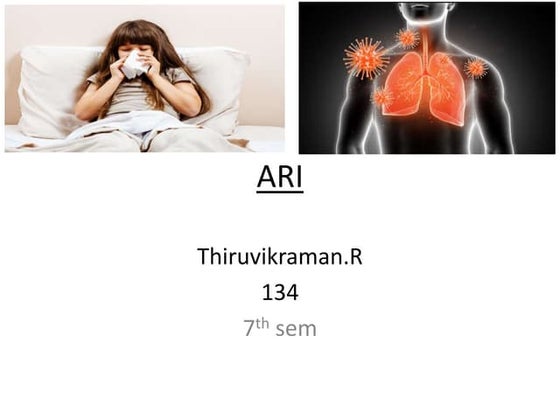 Acute Respiratory Infections Prevention and Control.ppt