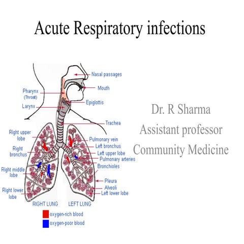 Acute Respiratory Infection and SARS with IMNCI management | PPT