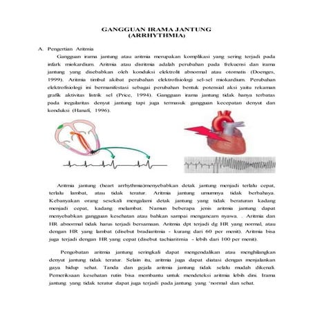 Aritmia1 | PDF