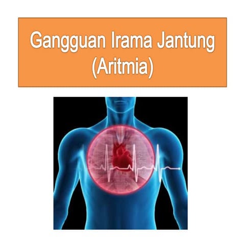 Aritmiaa | PPT