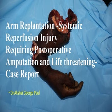 Arm Replantation -Systemic Reperfusion Injury.pptx