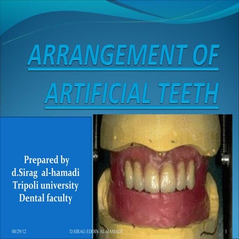 Arrangement of artificial teeth 1 | PPT