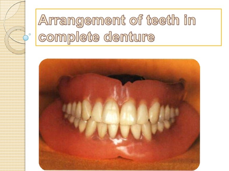 Arrangement of teeth in complete denture