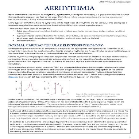 Arrhythmia: Mechanism, Classification, ECG features | PDF