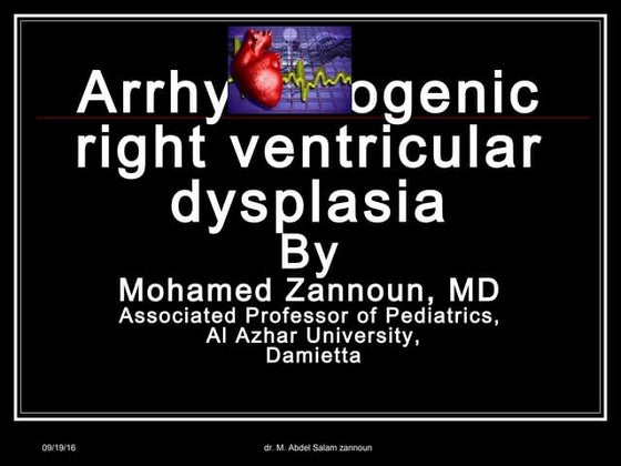 Arrhythmogenic Right Ventricular Dysrhythmias.pptx