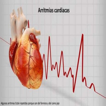 Arritmias.pptx