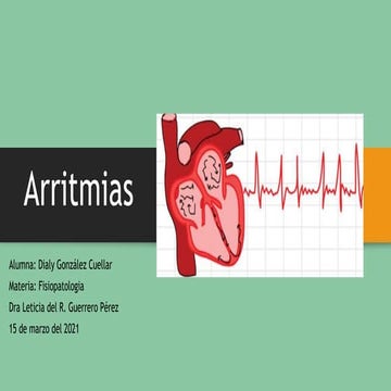 Arritmias.pptx