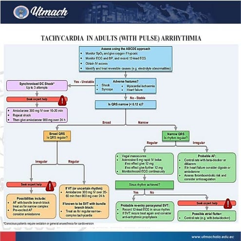 Arritmias algorithm | PPT