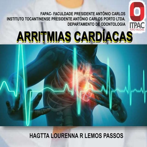 Arritmias Cardiacas | PPTX