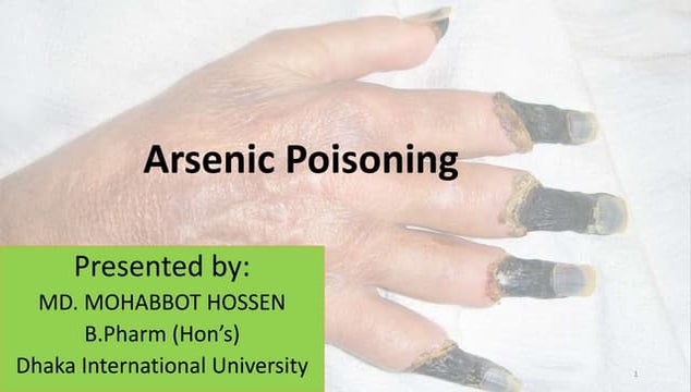 Arsenic Poisoning Fingernails