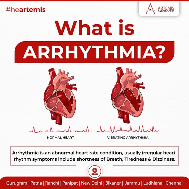 Revolutionizing Arrhythmia Diagnosis and Treatment | PDF