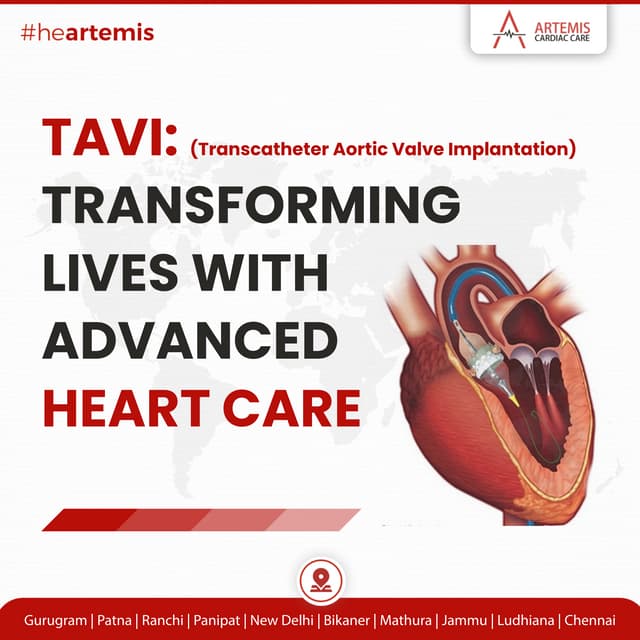 Revolutionizing Heart Care: Transcatheter Aortic Valve Implantation (TAVI) | PDF | Heart and ...