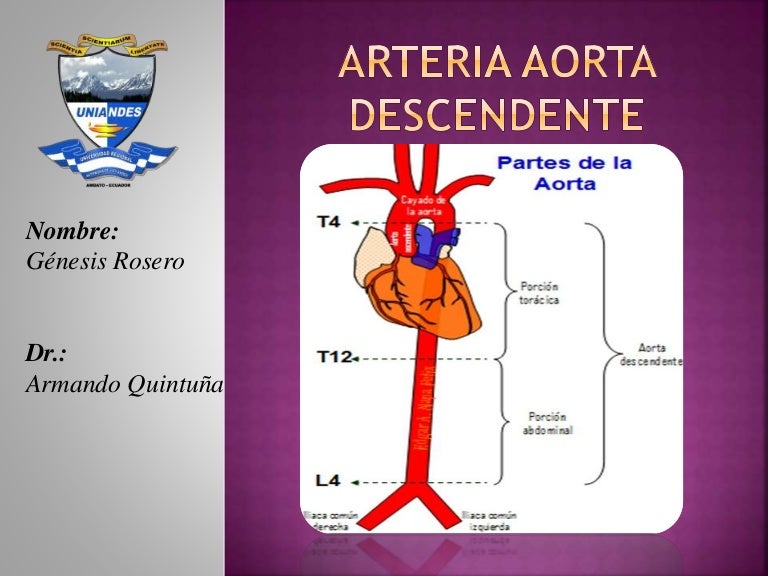 Arteria aorta descendente