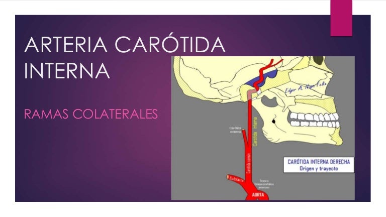 Arteria carótida interna