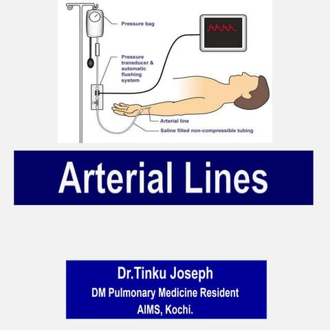 Arterial Line Venous Arterial Line Set Unilene