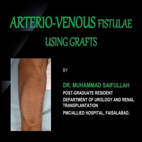 Arterio venous fistulae using grafts | PPTX