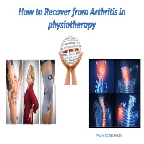 How to Recover from Arthritis in physiotherapy. | PPT